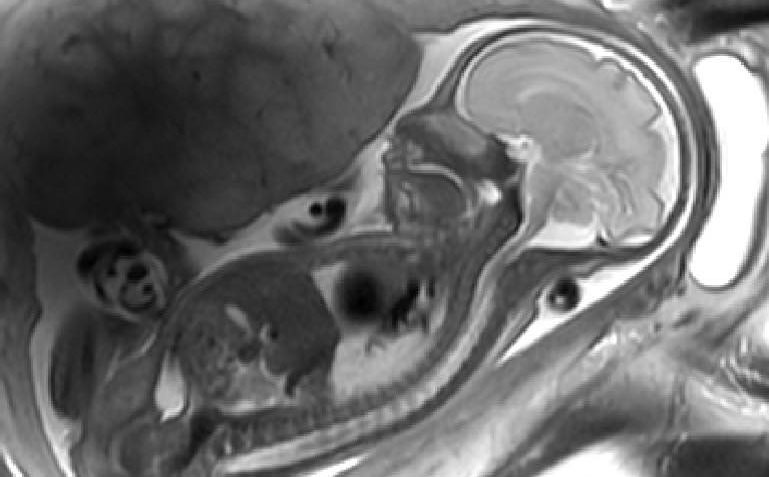 News - MRI pregnancy study gives new insights into the all-important ...